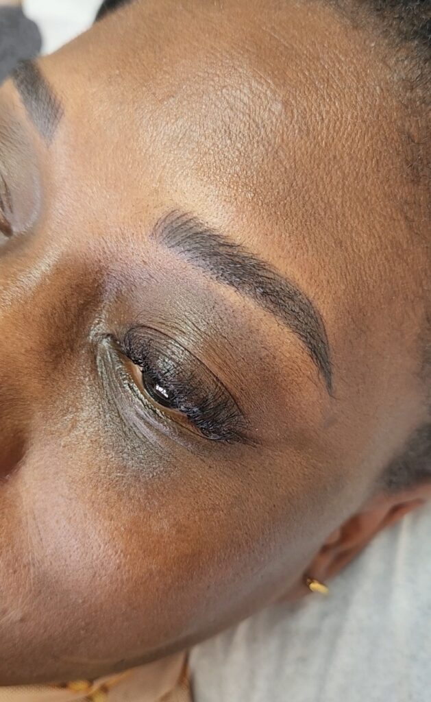 Gallery - Eyebrows - Cosmedico